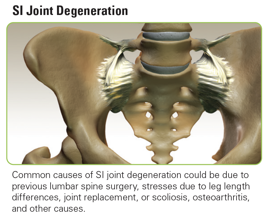 Si Joint Treatment San Juan Regional Medical Center